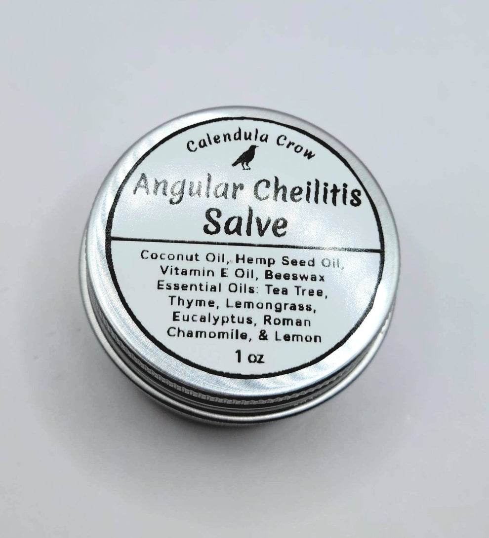 ANGULAR CHEILITIS LIP SALVE – Calendula Crow